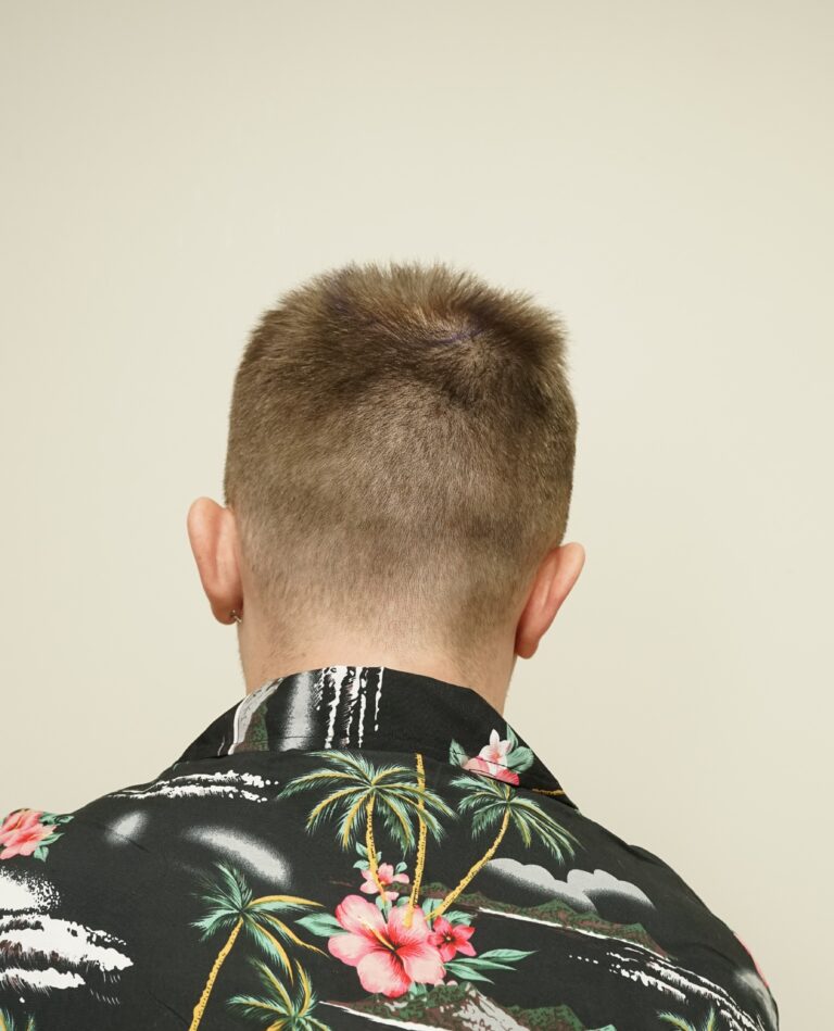 Hair Density: What It Means, How to Measure & Ways to Improve - Estenove