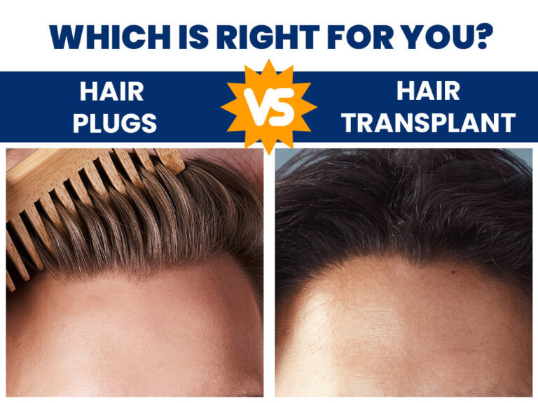 Hair Transplant vs. Hair Plugs: Which Is Right for You? - Estenove