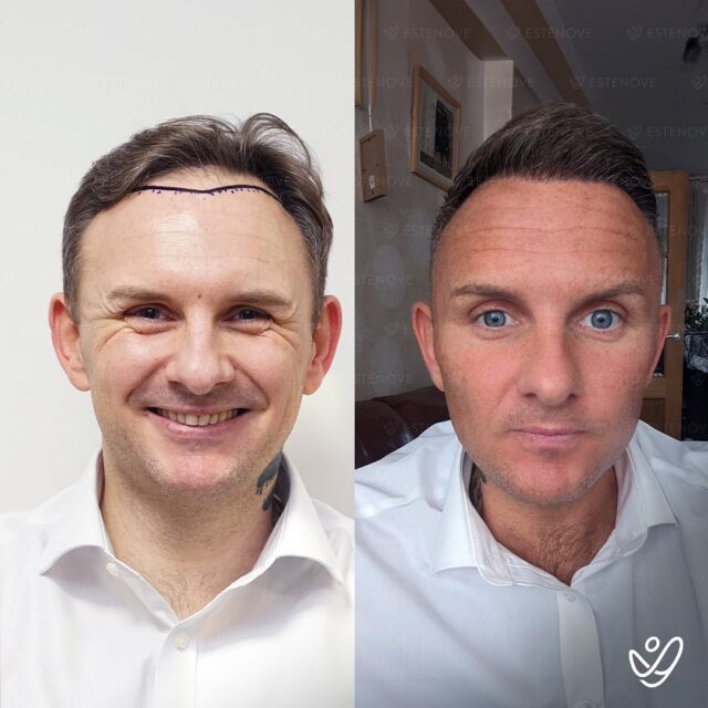 Billy Bob Thornton Wig - Estenove